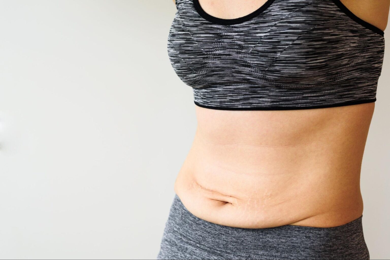 Flacidez abdominal, ¿cómo eliminarla de forma efectiva? – Metaclinic